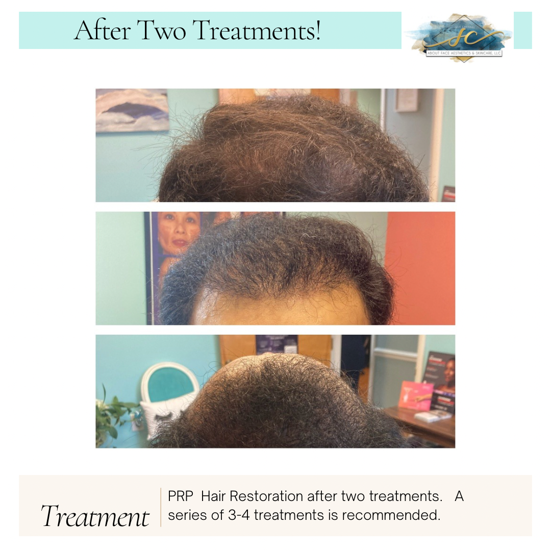 Our Specials - About Face Medspa & Wellness